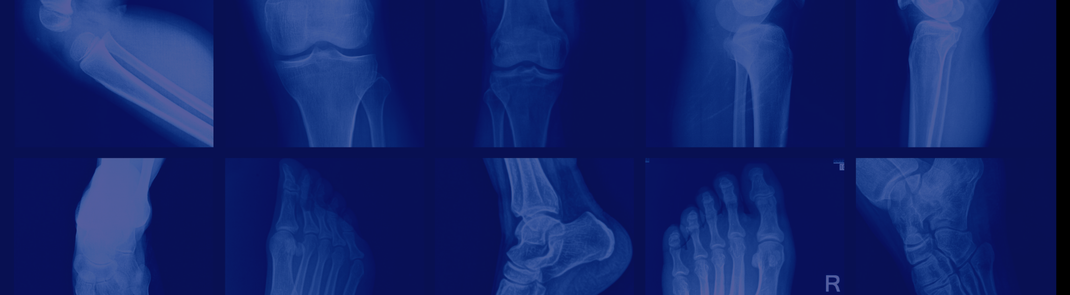 Xray – Rouse Hill Radiology